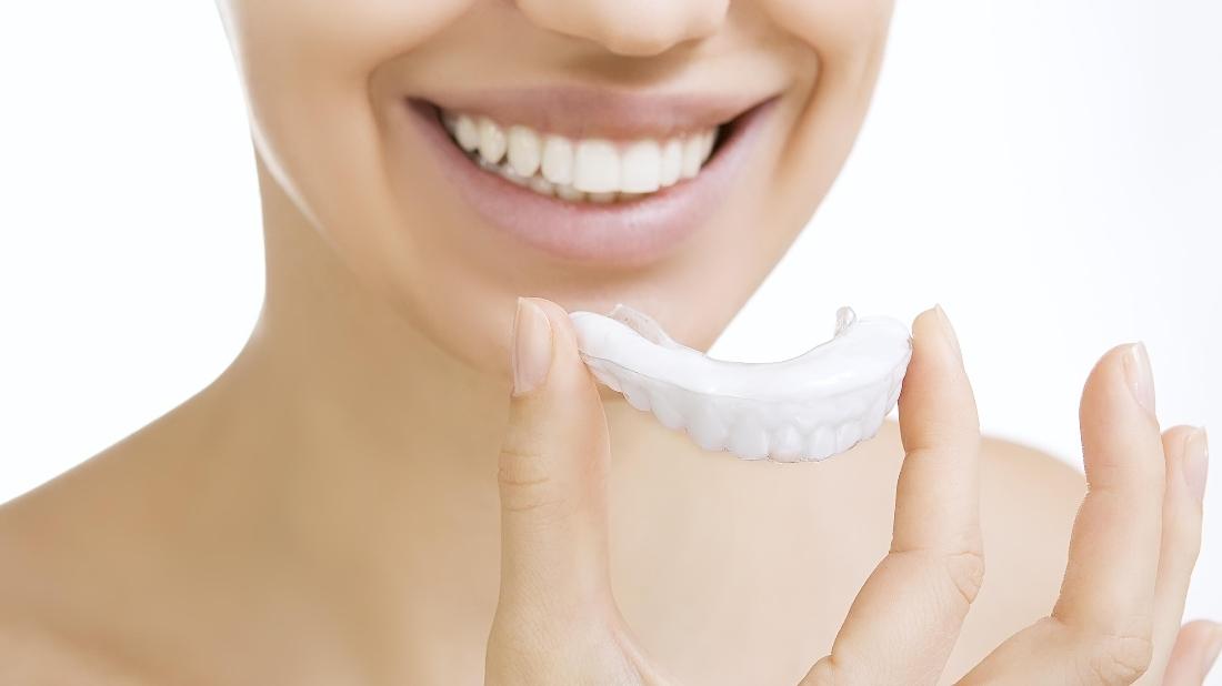Teeth Whitening Formula Blog Post | Jensen Beach Dental